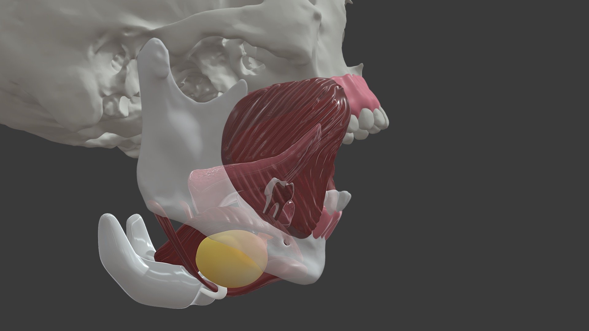 Stage 5 - Mandibular Molar Infection pathway 4 - 3D model by University ...