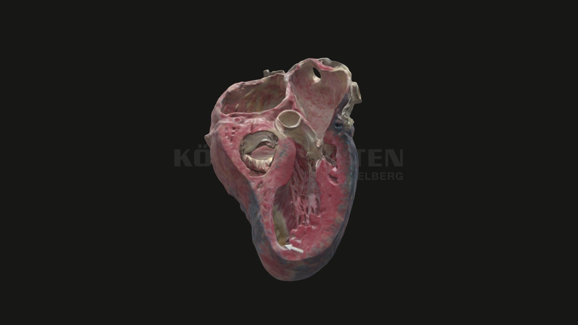 Heart high-poly textured - 3D model by Dimension3 [db881c9] - Sketchfab