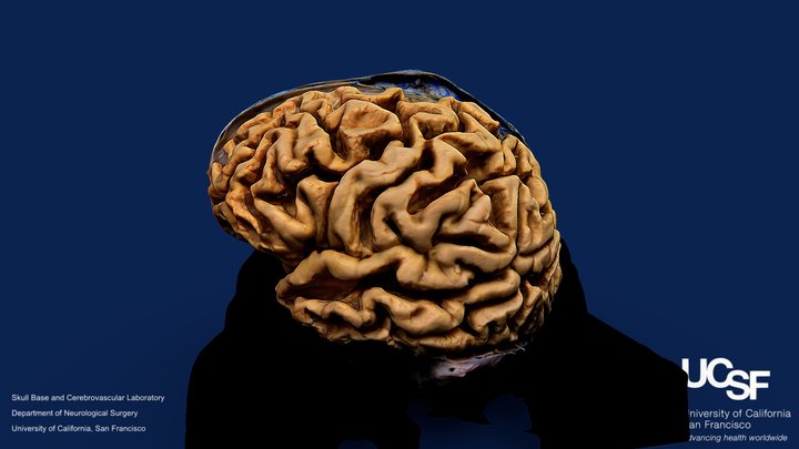 White-matter 3D models - Sketchfab
