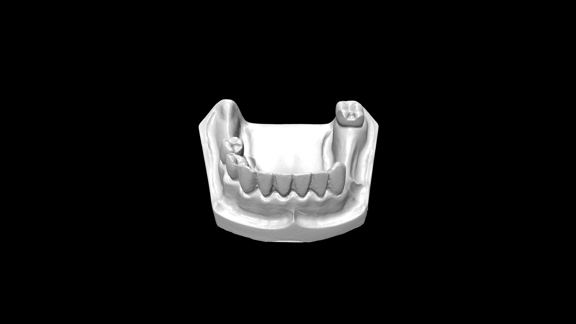 RPD Exercise: Modified dentoform - Preview - Download Free 3D model by ...