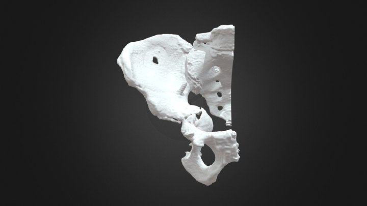 Hemipelvis 3D models - Sketchfab