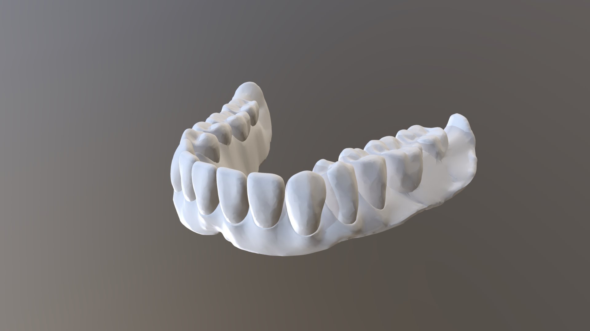 mandibular denture - 3D model by ramiammoun [dc81257] - Sketchfab