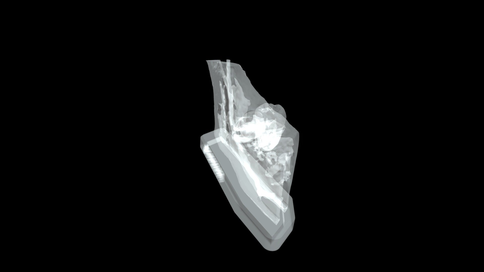 Third Molar - 3D model by biomed3d [dc91650] - Sketchfab