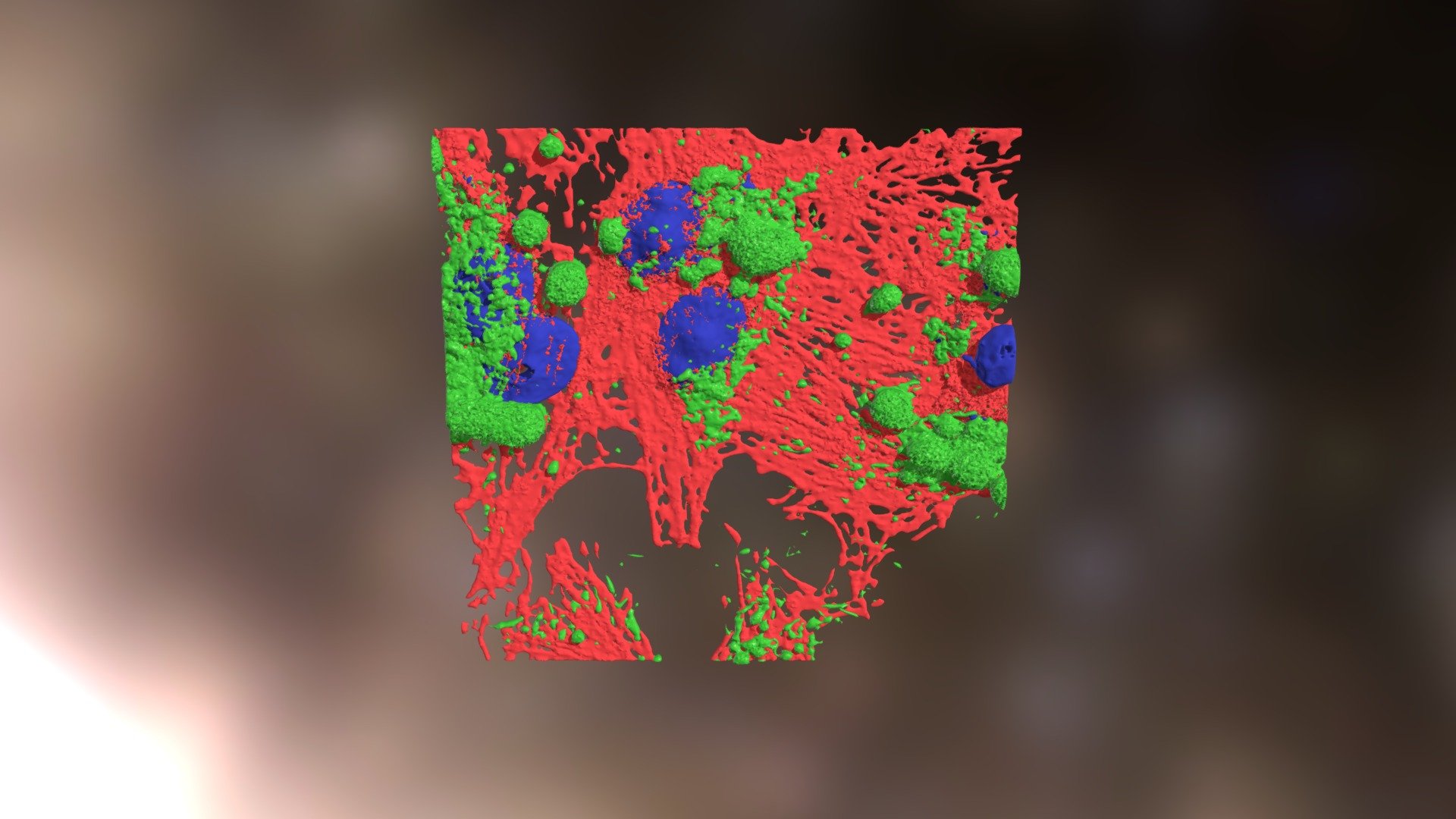 Respiratory Syncytial Virus Infected Cells - 3D model by XR Life ...