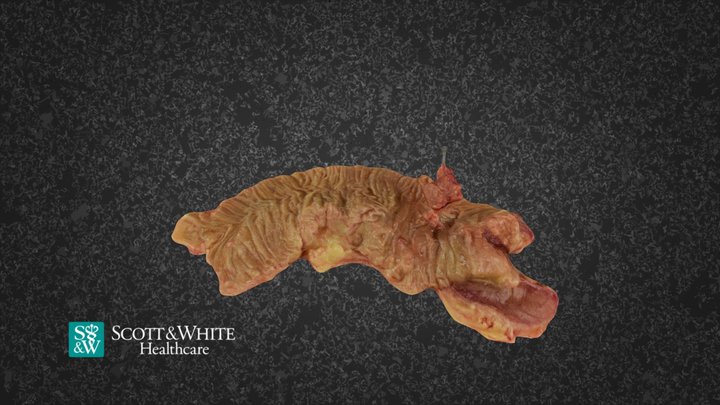 Jejunum 3D models - Sketchfab