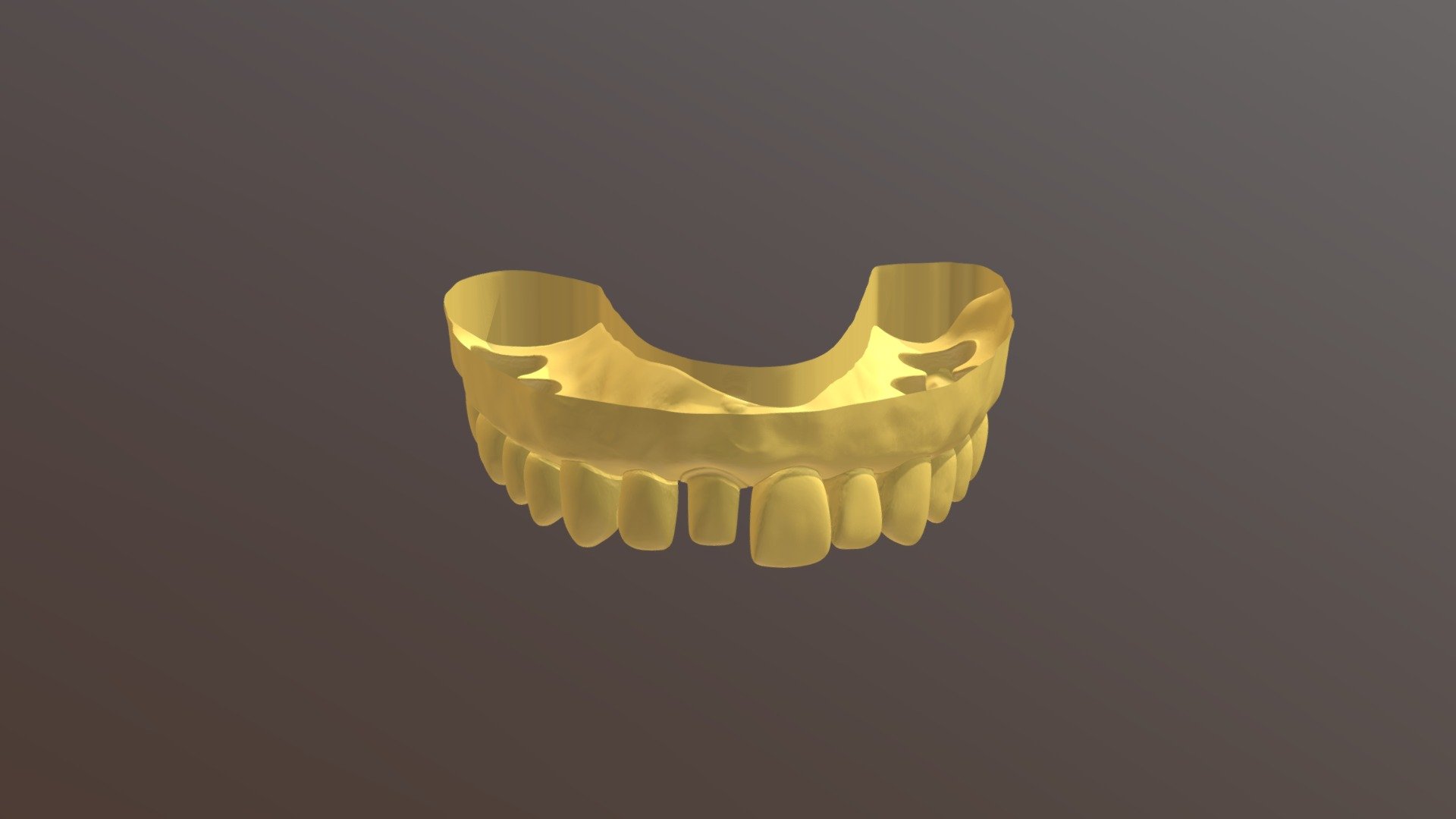 #8 All Ceramic Preparation Full Arch - 3D model by ramiammoun [dd31a02 ...