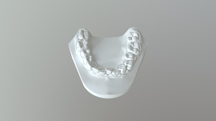Orthodontics 3D models - Sketchfab