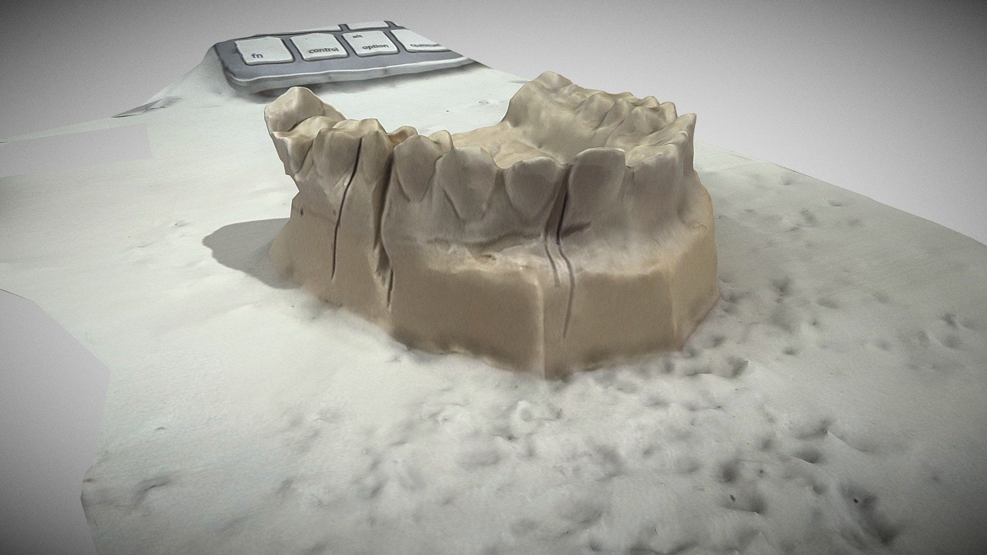 2022-07-13 Dental Model Crooked Tooth - 3D model by Bart Sakwerda - 3d ...