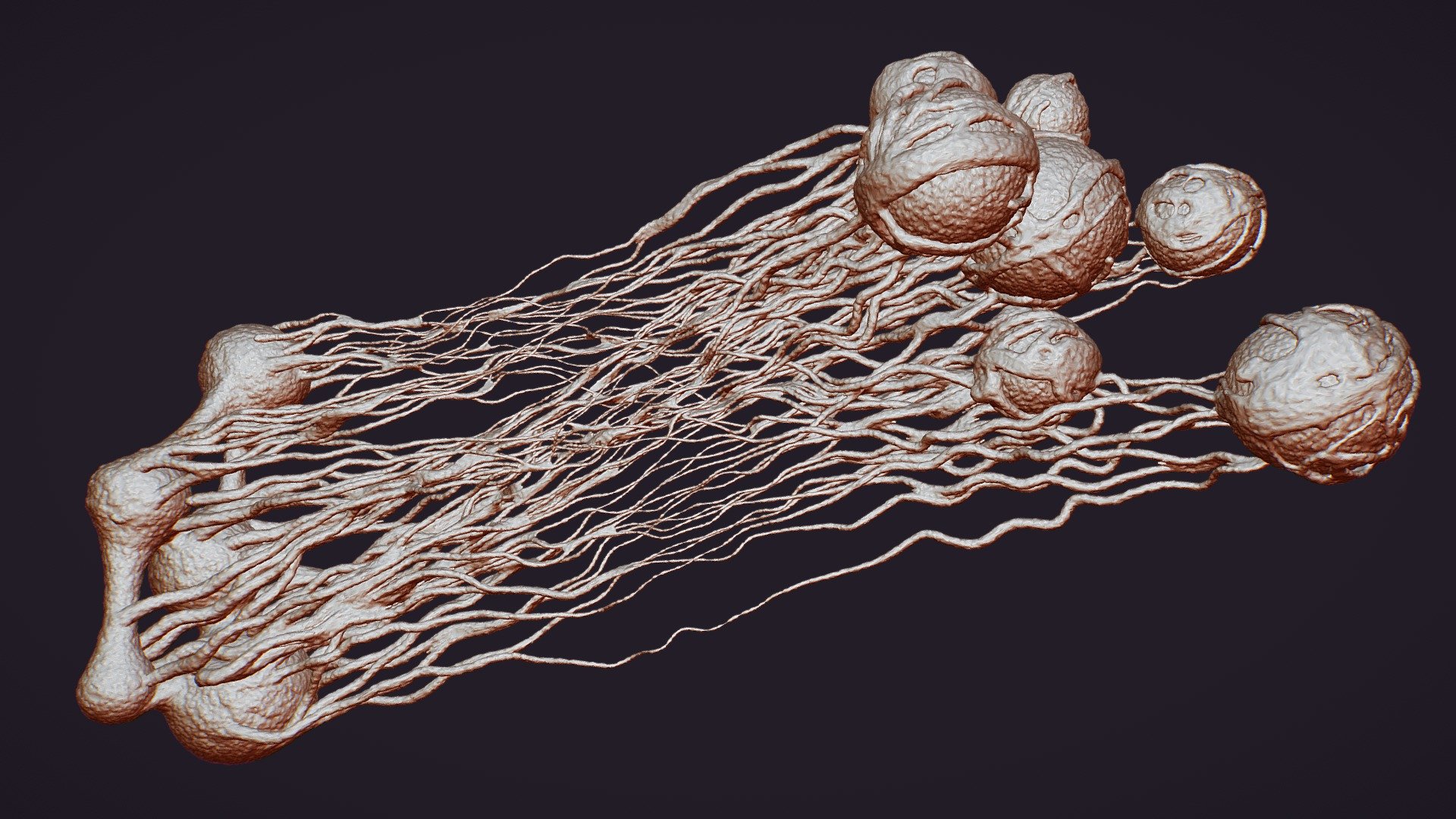 Cancer Growth 02 - 3D model by djkorg [dd9f6b9] - Sketchfab