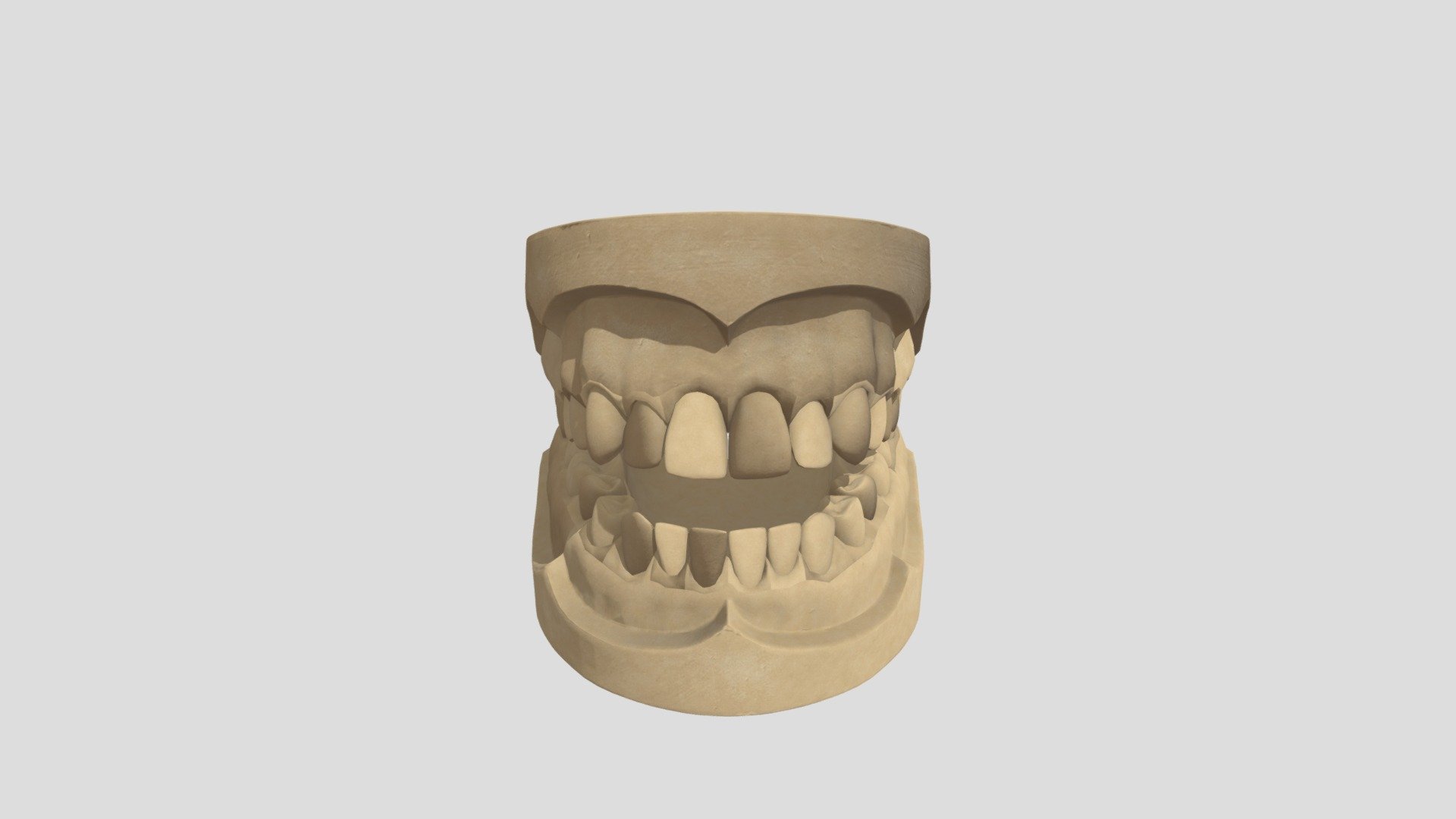 Dental_Mold - 3D model by dusek.vaclav [dddb2a0] - Sketchfab