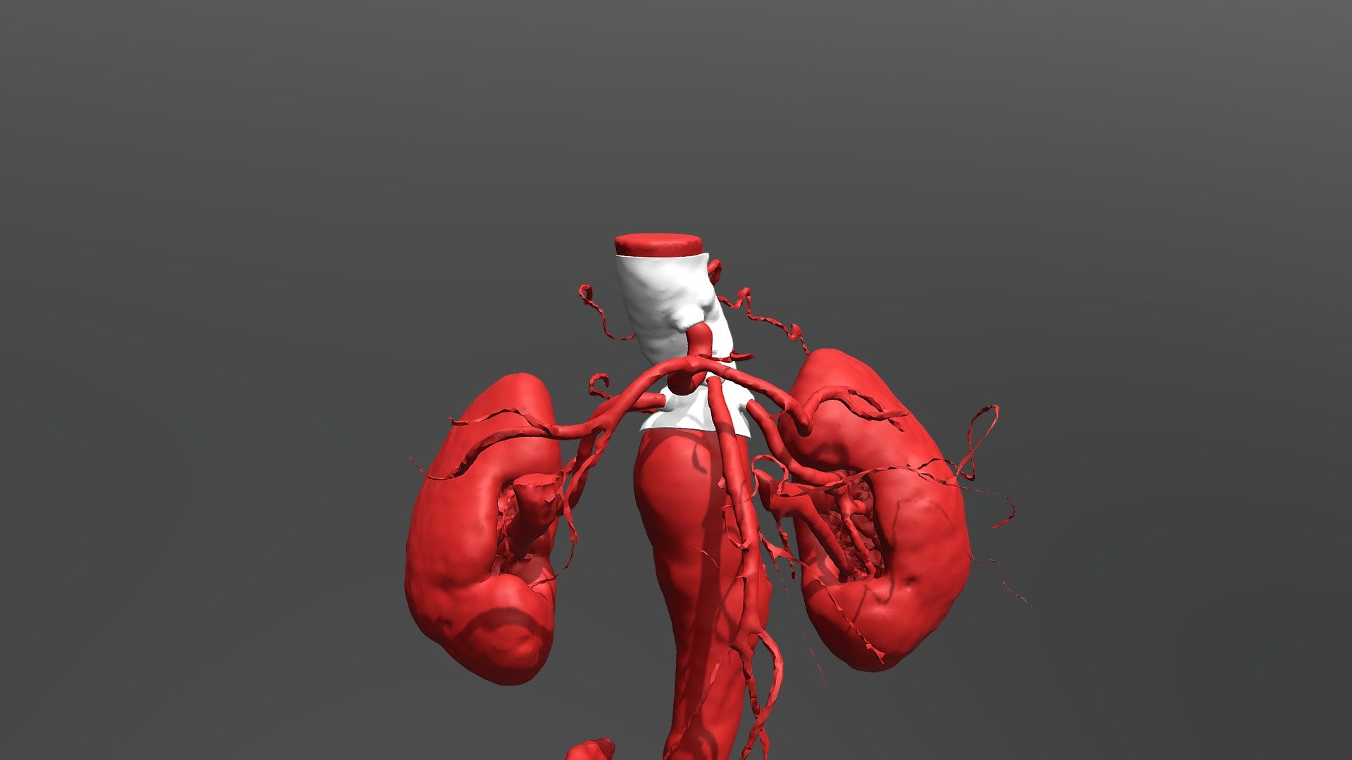 Aortic template for stent-graft fenestration - 3D model by valchanov ...
