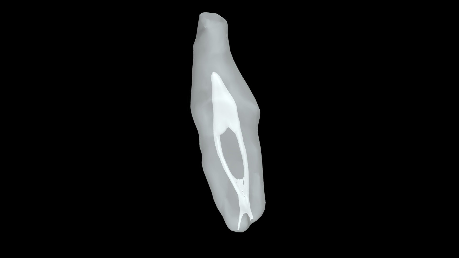 tooth 25 - 3D model by biomed3d [de7c0a6] - Sketchfab