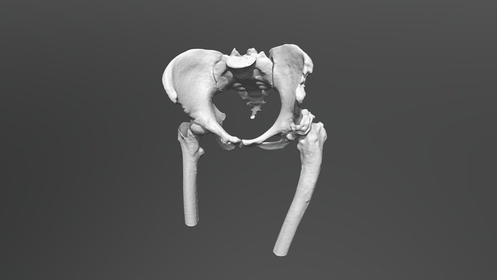 Acetabulum 3D models - Sketchfab