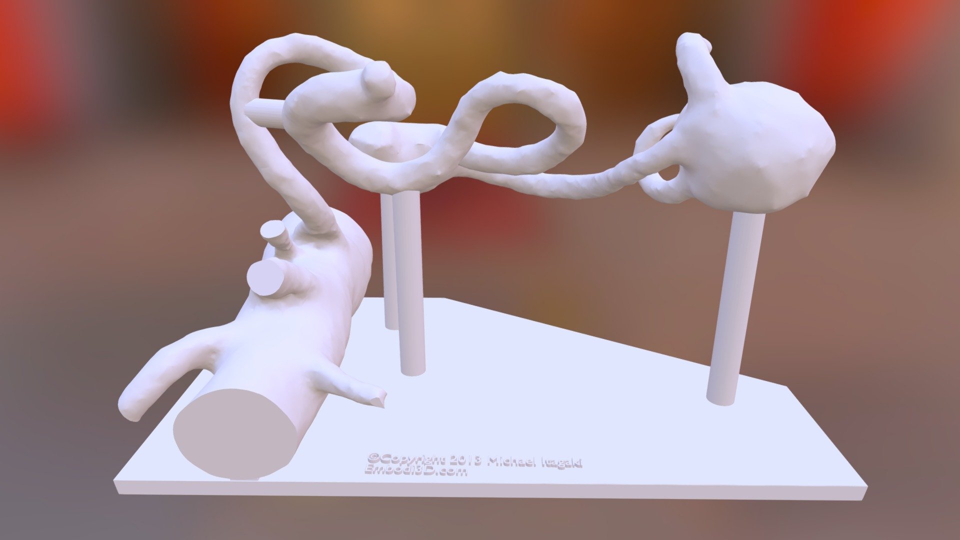 Splenic Artery Aneurysm, Lumen - Download Free 3D model by Bart (@bartv ...