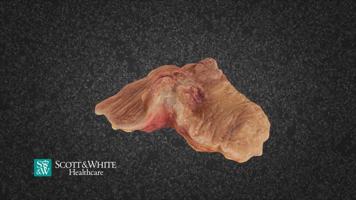 Colon 3D models - Sketchfab