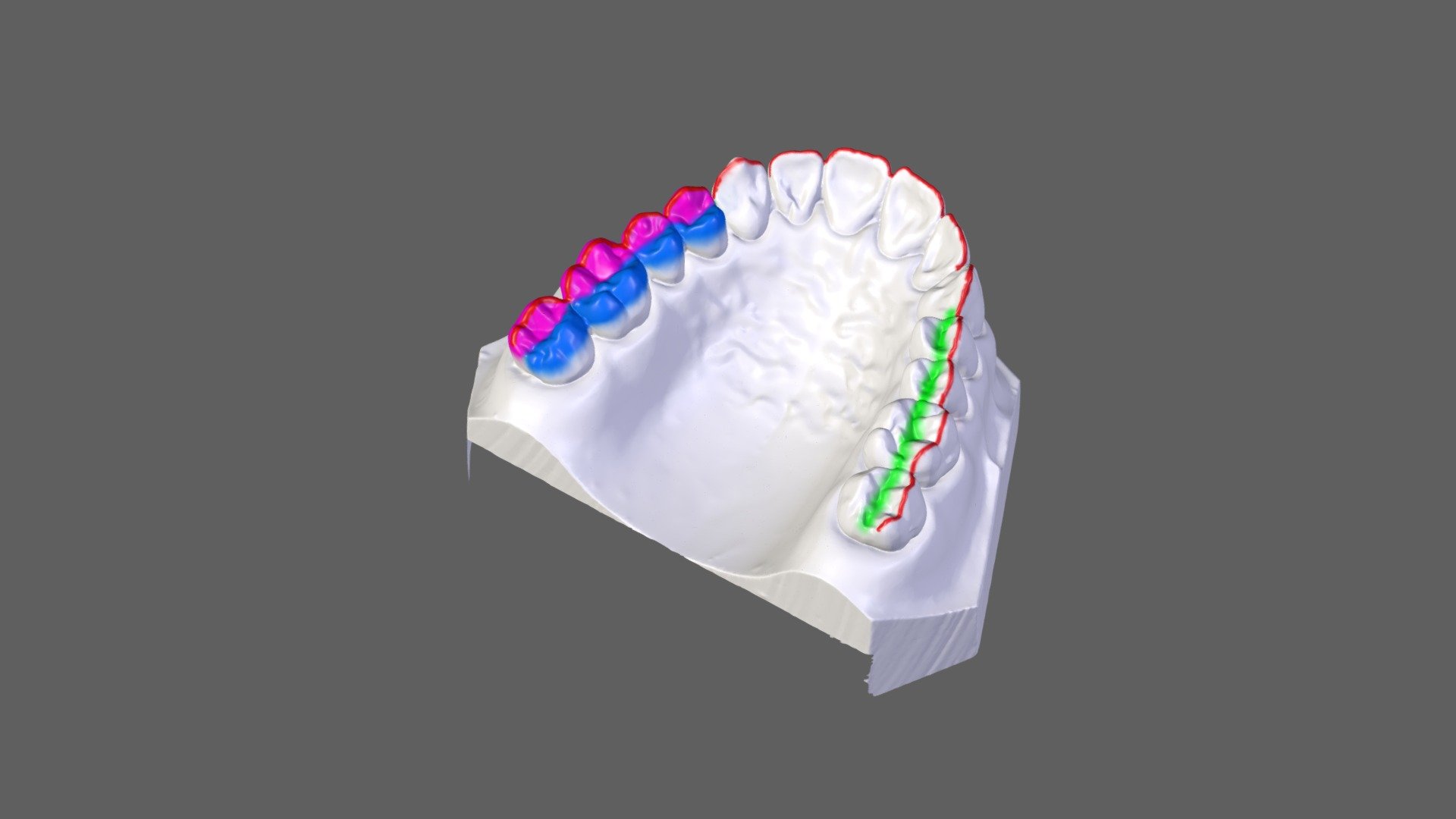 Arcada Superior - Cúspides - Download Free 3D model by Ricardo Armini Caldas (@opendentistry ...