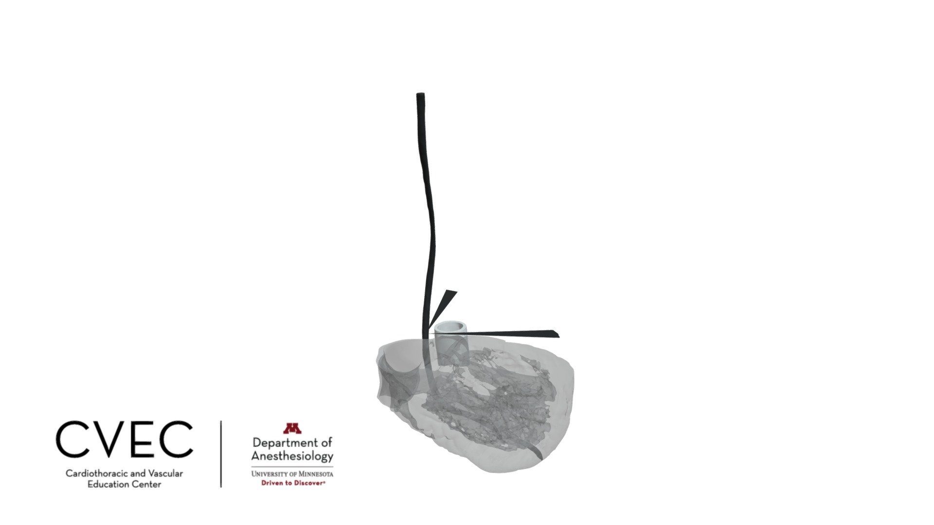 ME Esophageal Descending Aortic SAX - 3D model by CVEC [dfdfd3a ...