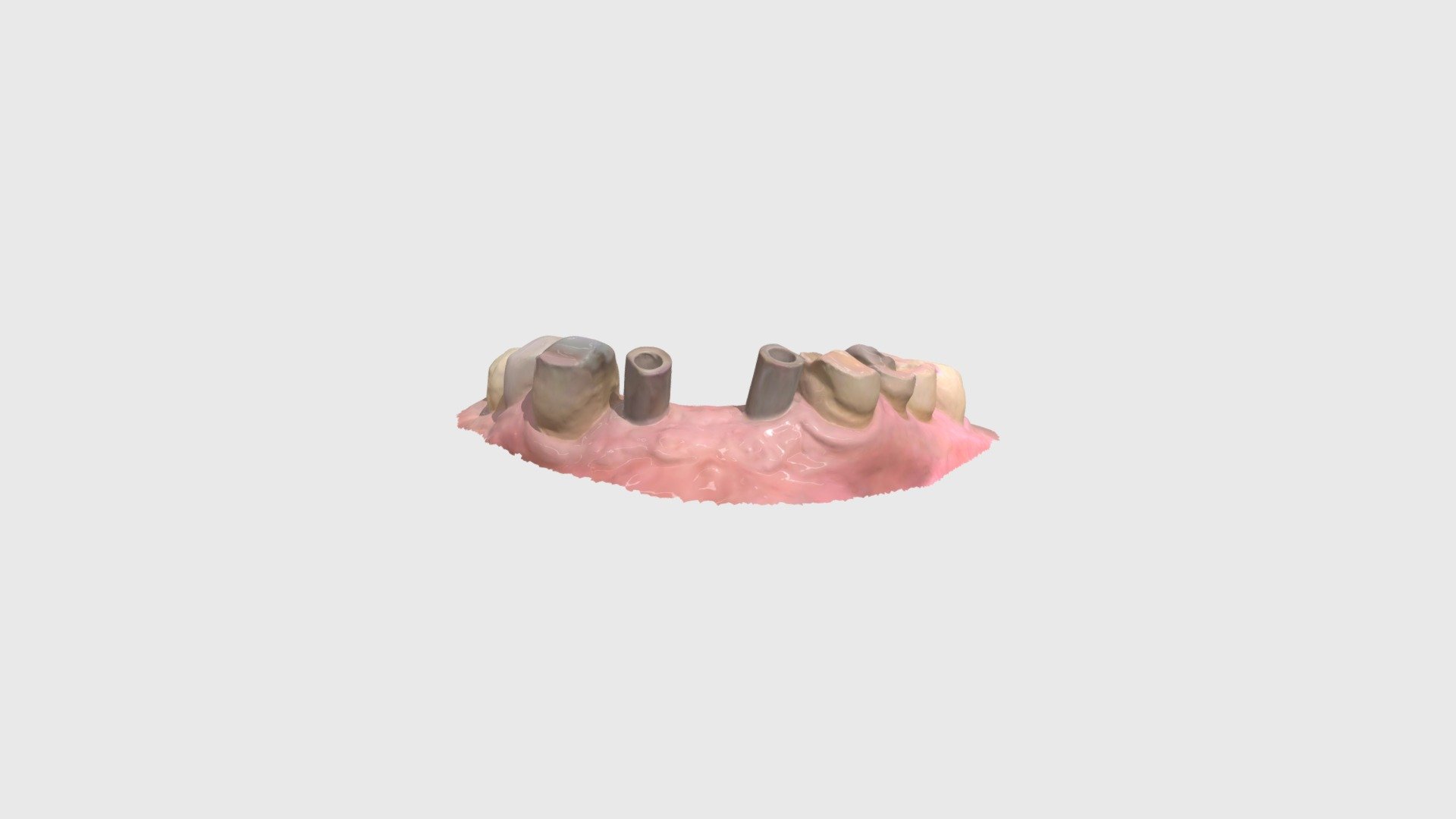 MM-edited Scanbody PLY (1) - 3D model by gpnypc [e094daa] - Sketchfab