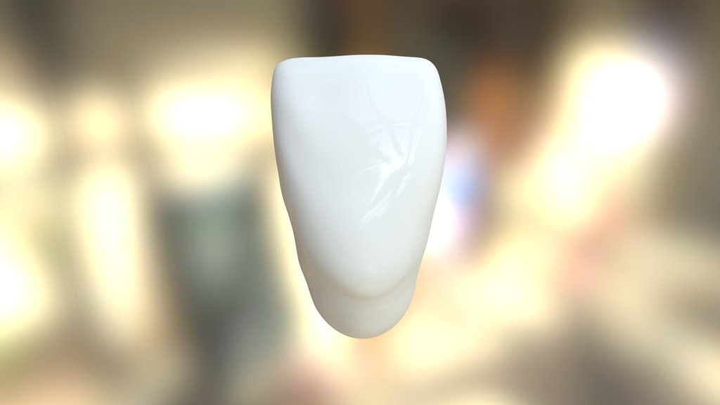 Lower left lateral - 3D model by digitaldentistryeducation (@c ...