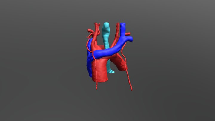 Aorta 3D models - Sketchfab