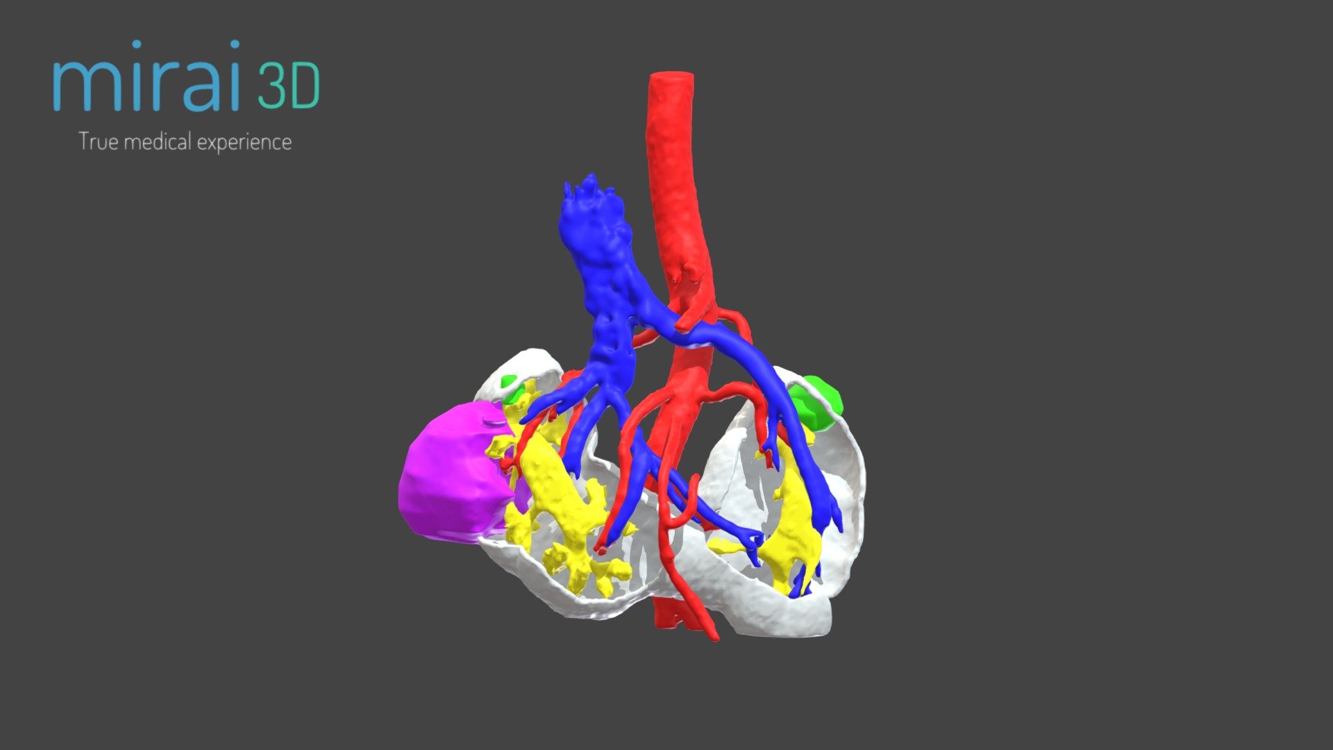 Medical Model WP3 - Buy Royalty Free 3D model by MIRAI3D [e1cd64a ...