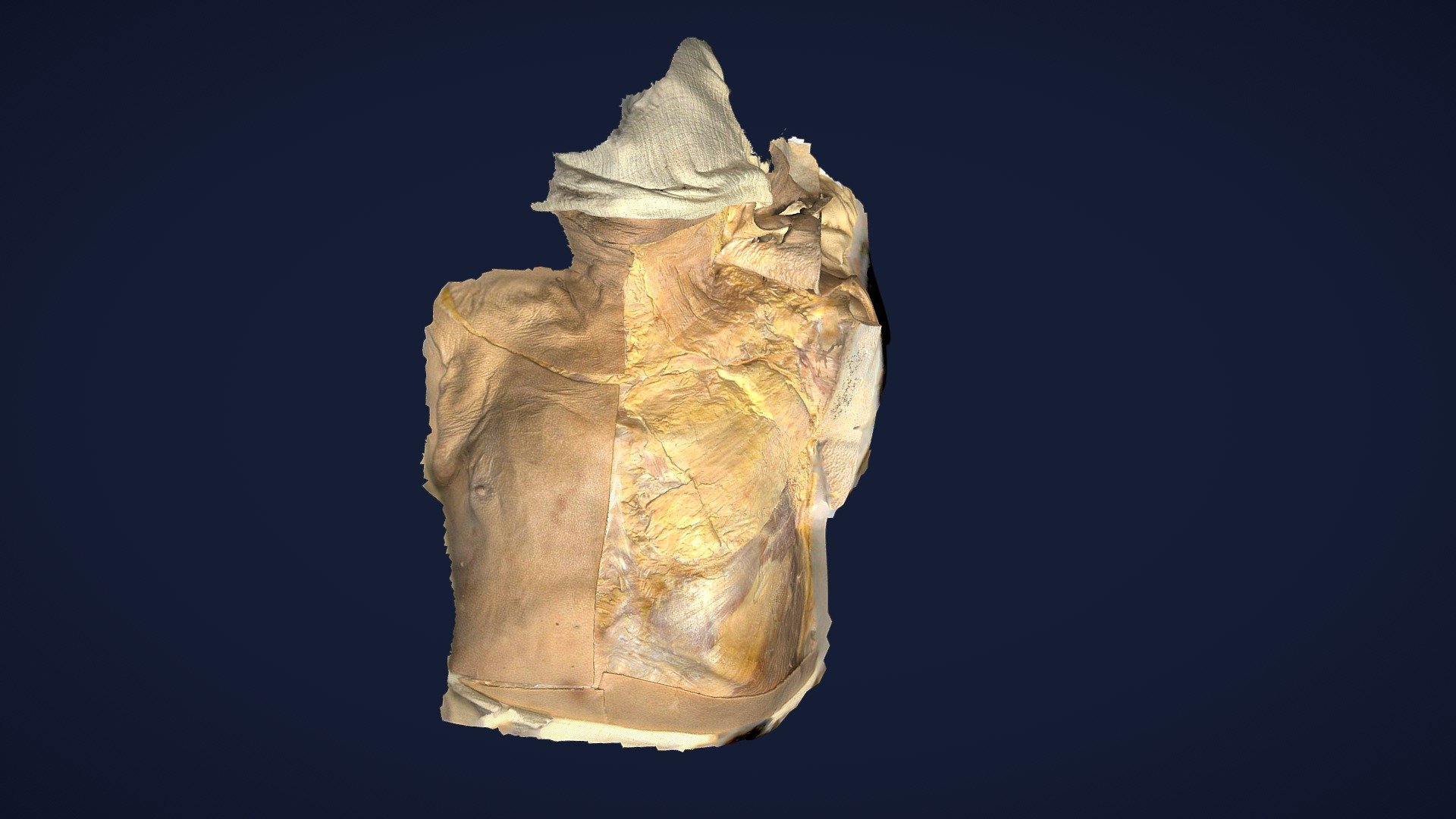 Halsbereich, Platysma - copy - 3D model by Institute of Anatomy Rostock ...