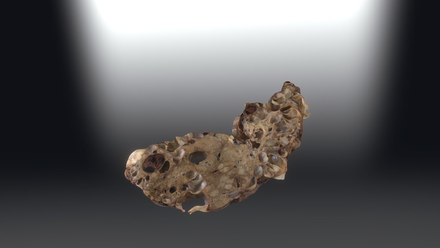 liver with fissures - Download Free 3D model by ScienceLifeNY [e1fe491 ...