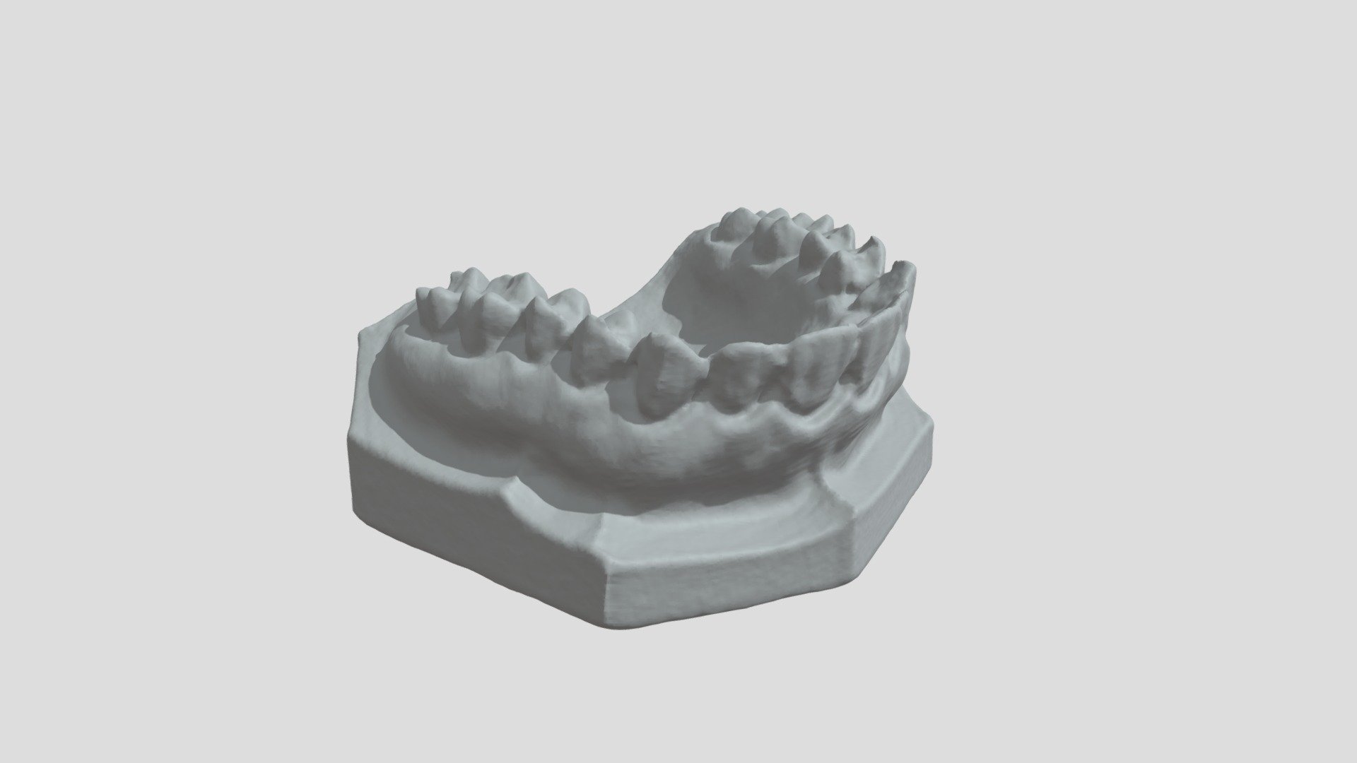 Teeth Scanning by CR-Scan Lizard - Download Free 3D model by CR-Scan ...