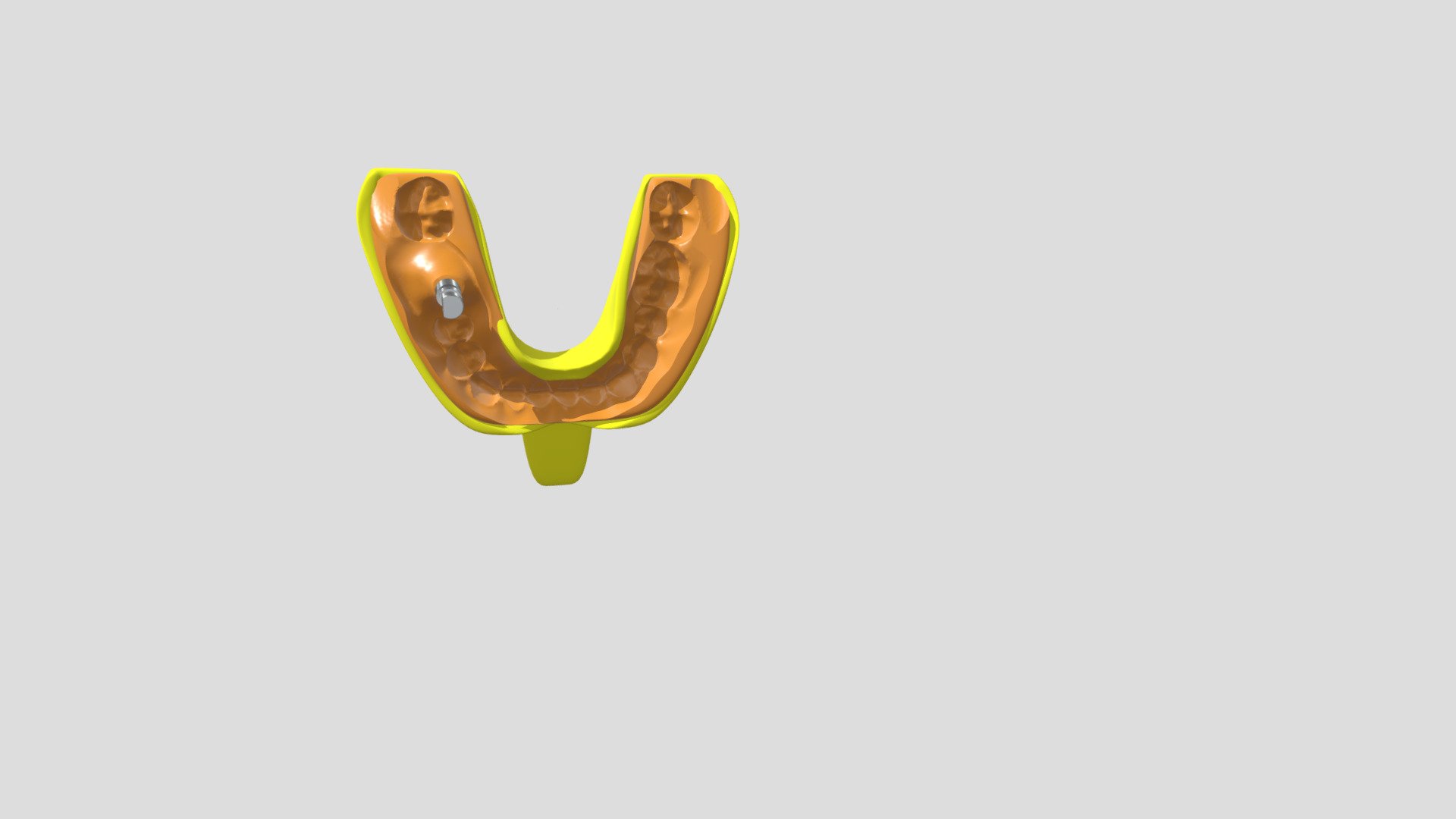 Working cast - Implant - 3D model by Mateus Bertolini (@mateusbertolini ...