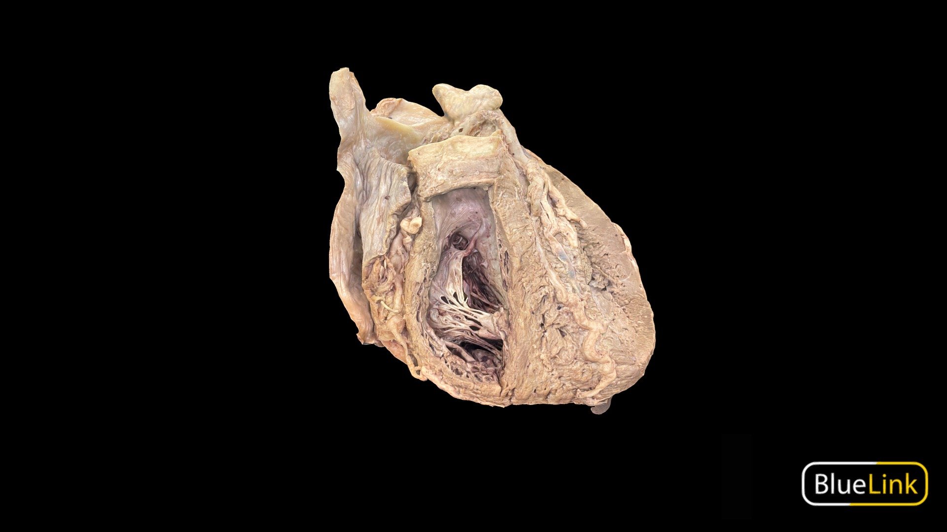 403 Internal Heart Features - 3D model by Bluelink Anatomy ...