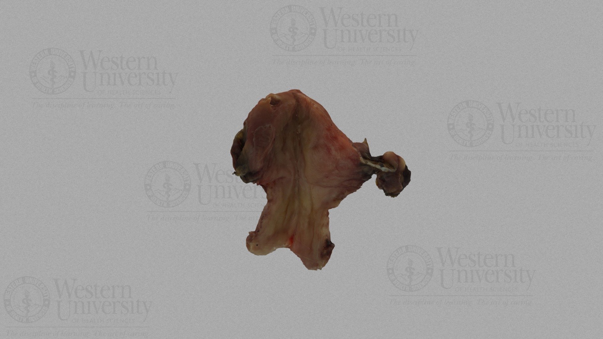 300115 Human Uterus with Cervix - 3D model by WesternU3D [e3ae3ad ...
