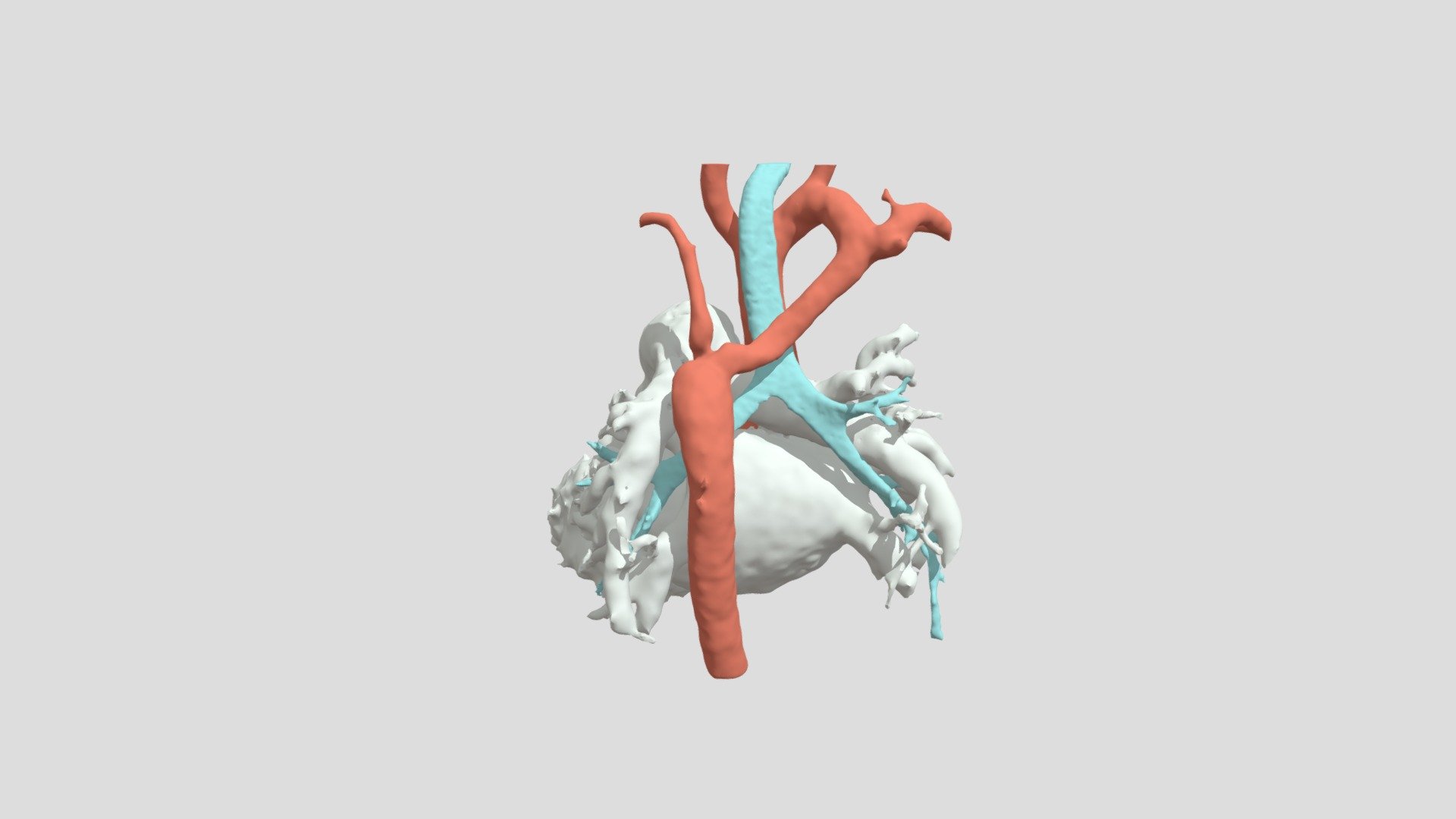 VSD, Aortic Arch (S0365) - 3D model by NCH Advanced Projects Laboratory ...