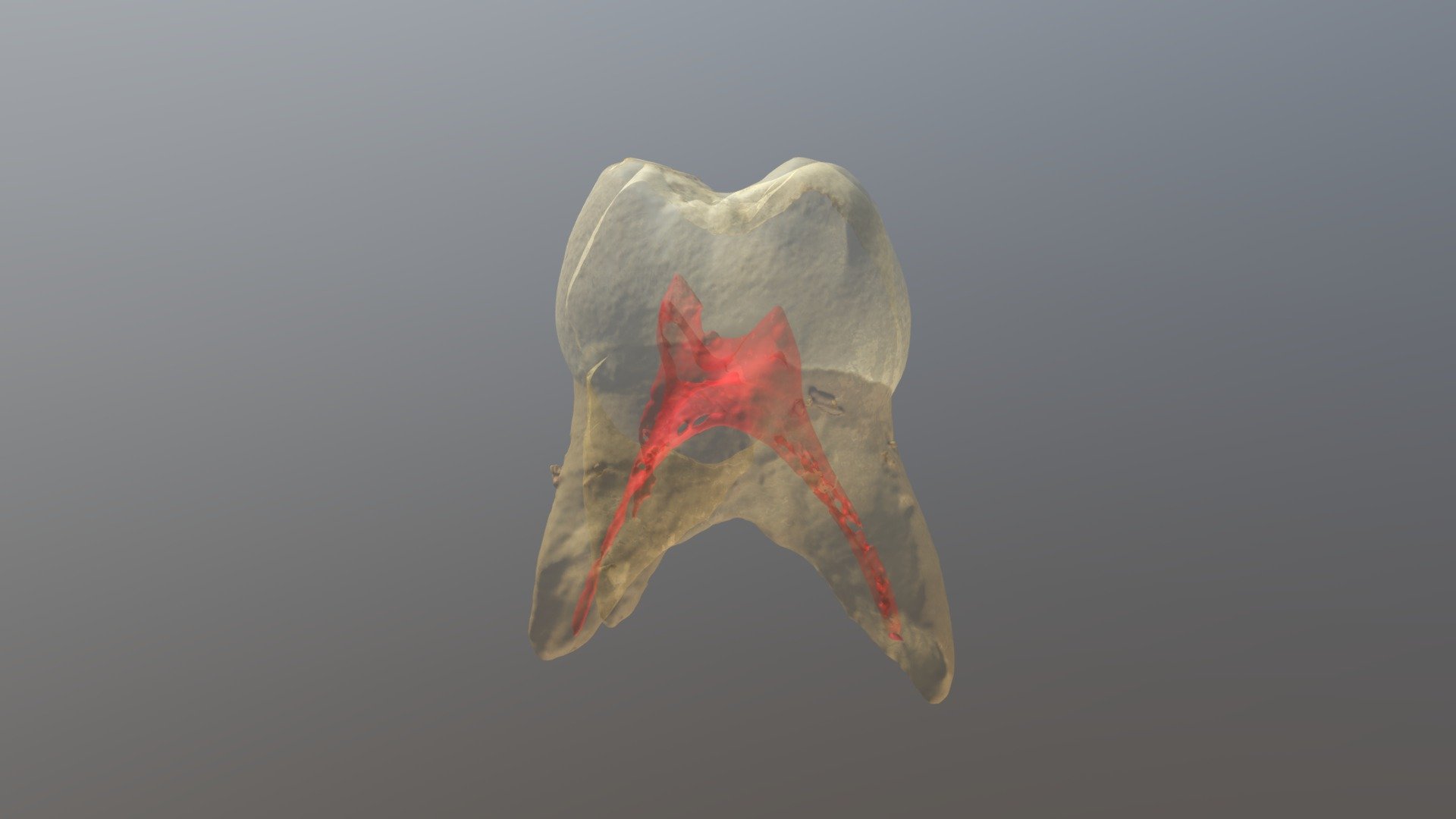 Human Deciduous Tooth - 3D model by Alexander Jon Cresswell-Boyes ...