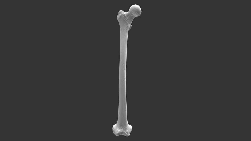Right Femur - 3D model by Wellesley College (@WellesleyCollege ...
