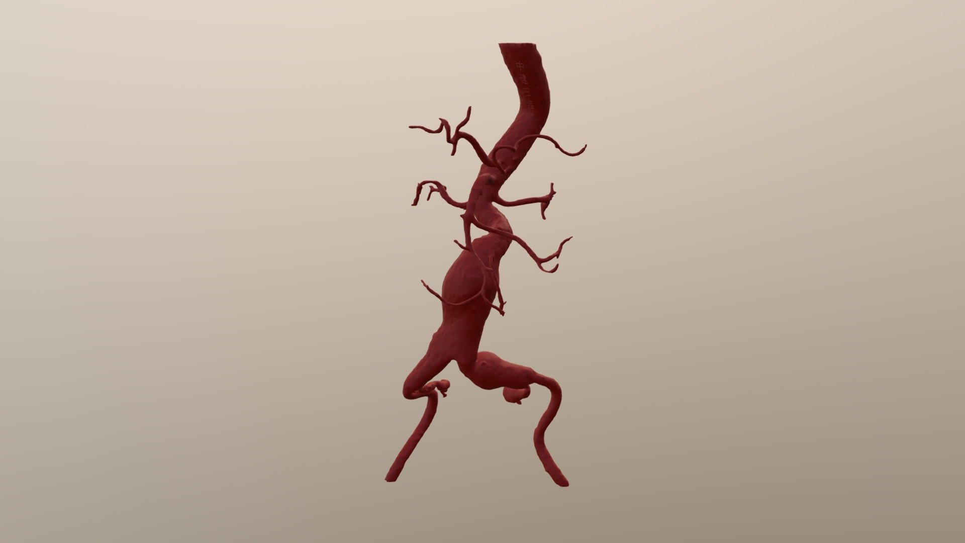 GENG SHUAN HU Aorta 1 001 - 3D model by anxiaoning [e49834d] - Sketchfab