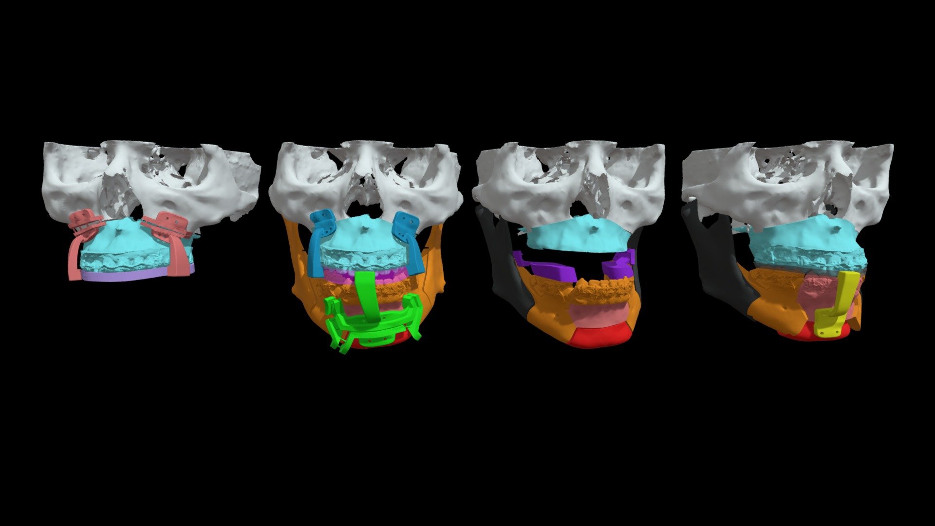 MMH Dr.Chen 專區 -0310 - 3D model by vivian.detekt [e4aff3d] - Sketchfab