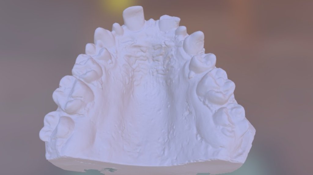 RA Upper - 3D model by ushefdentistry [e54b3d1] - Sketchfab