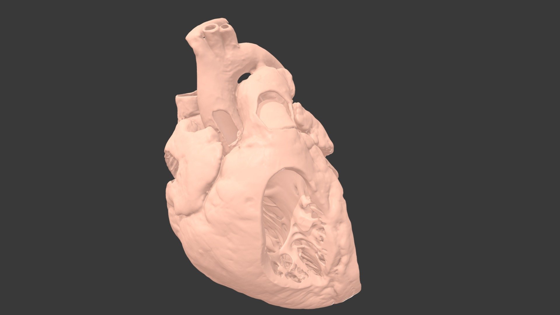 Normal #7 - Normal heart {S,D,S} - 3D model by heartmodels [e550fbd ...