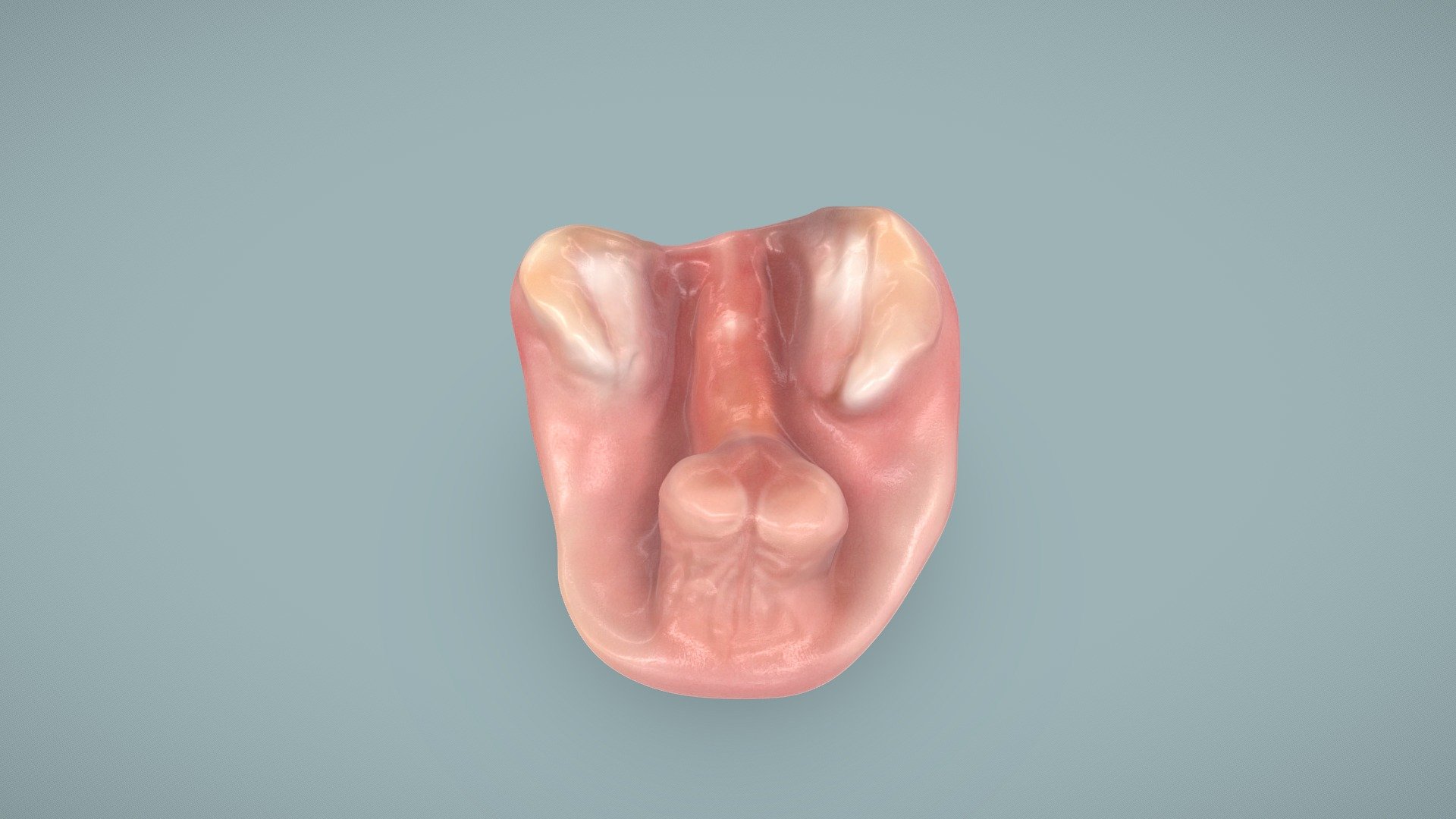Bilateral Cleft Palate - 3D model by AUmedart [e5c07ba] - Sketchfab