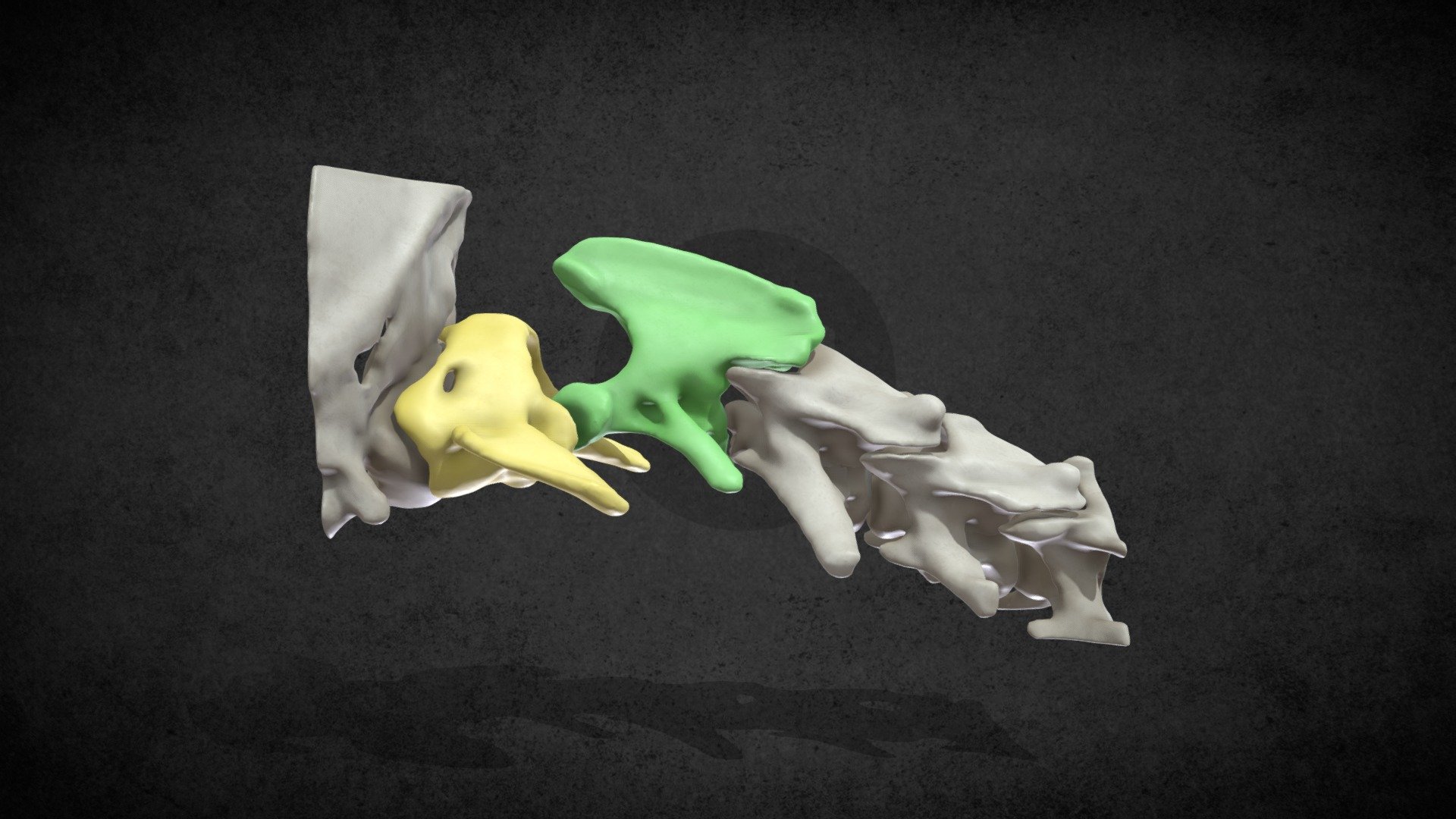 Atlantoaxial subluxation (ID5520) - 3D model by LimesVet [e5dc14b ...
