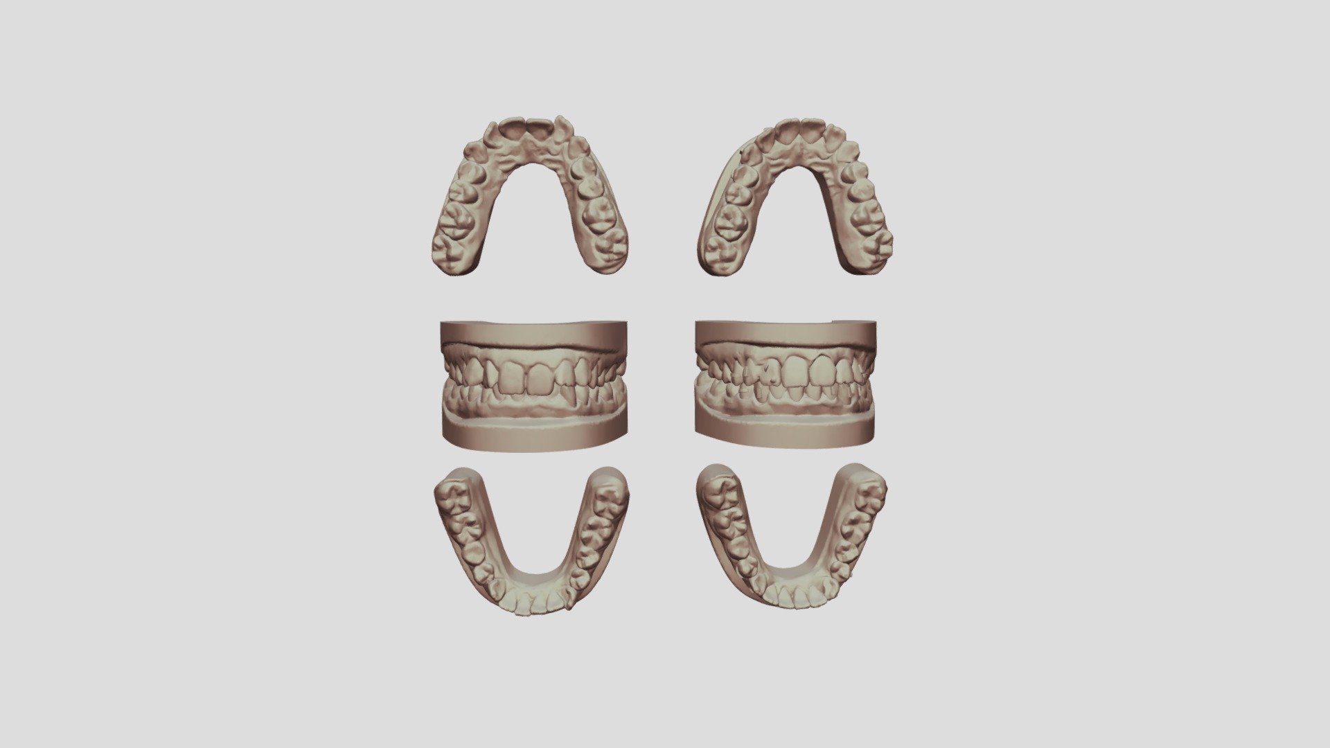 MLA - 3D model by 001 (@uzegeortho) [e5edc39] - Sketchfab