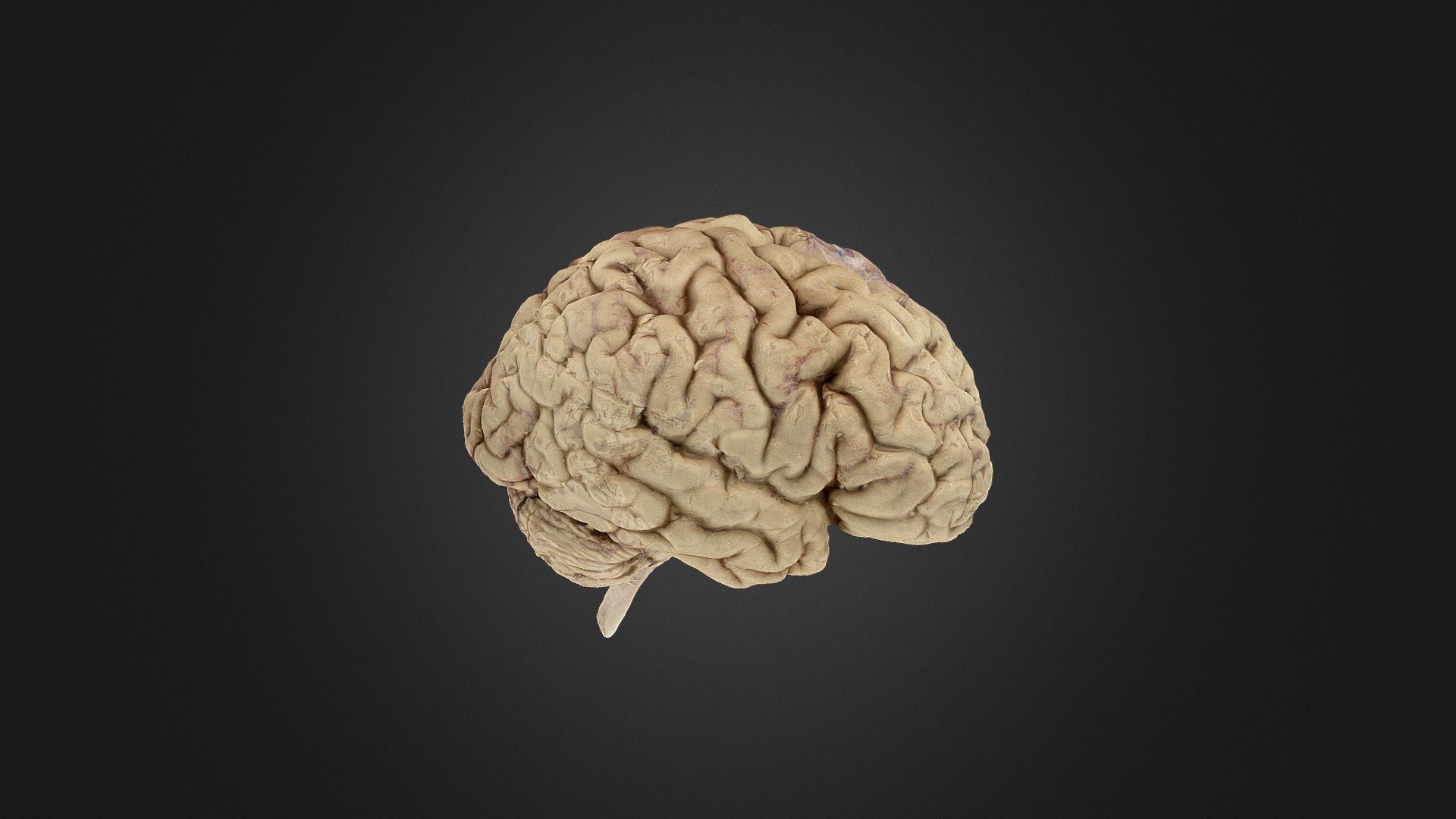 Brain Before Sections (Posterior labels) - 3D model by ...
