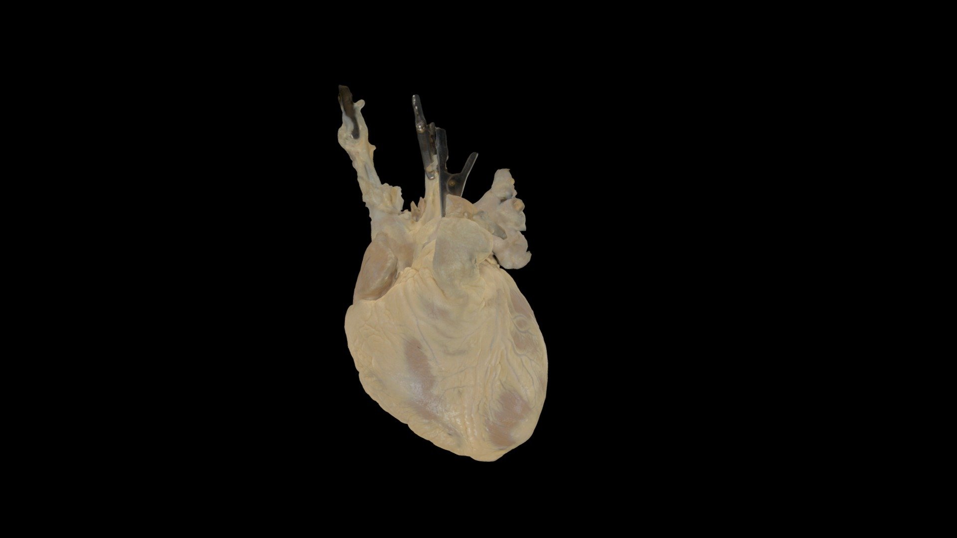 Pediatric Human Heart Donation - Download Free 3D model by ...