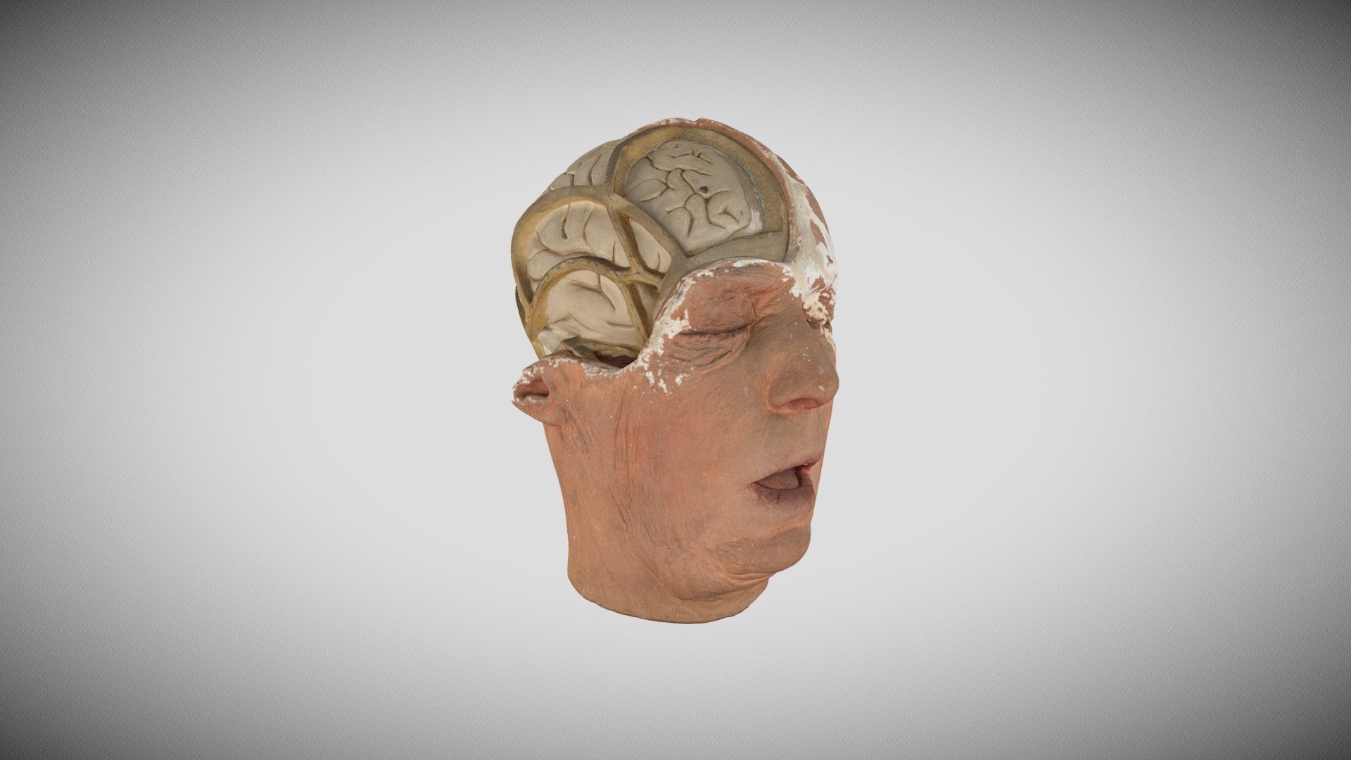 Model of the Head of an Older Man, Brain Exposed - Download Free 3D ...