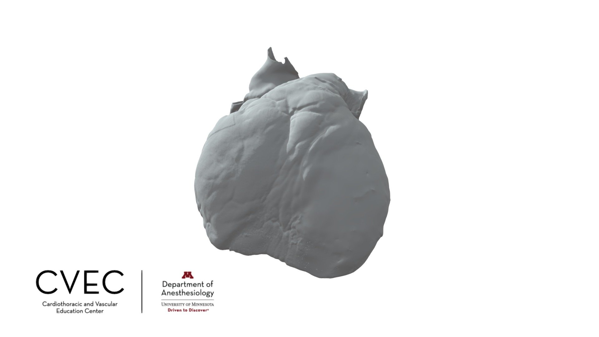 Heart with TAVR and PFO - 3D model by CVEC [e65871e] - Sketchfab