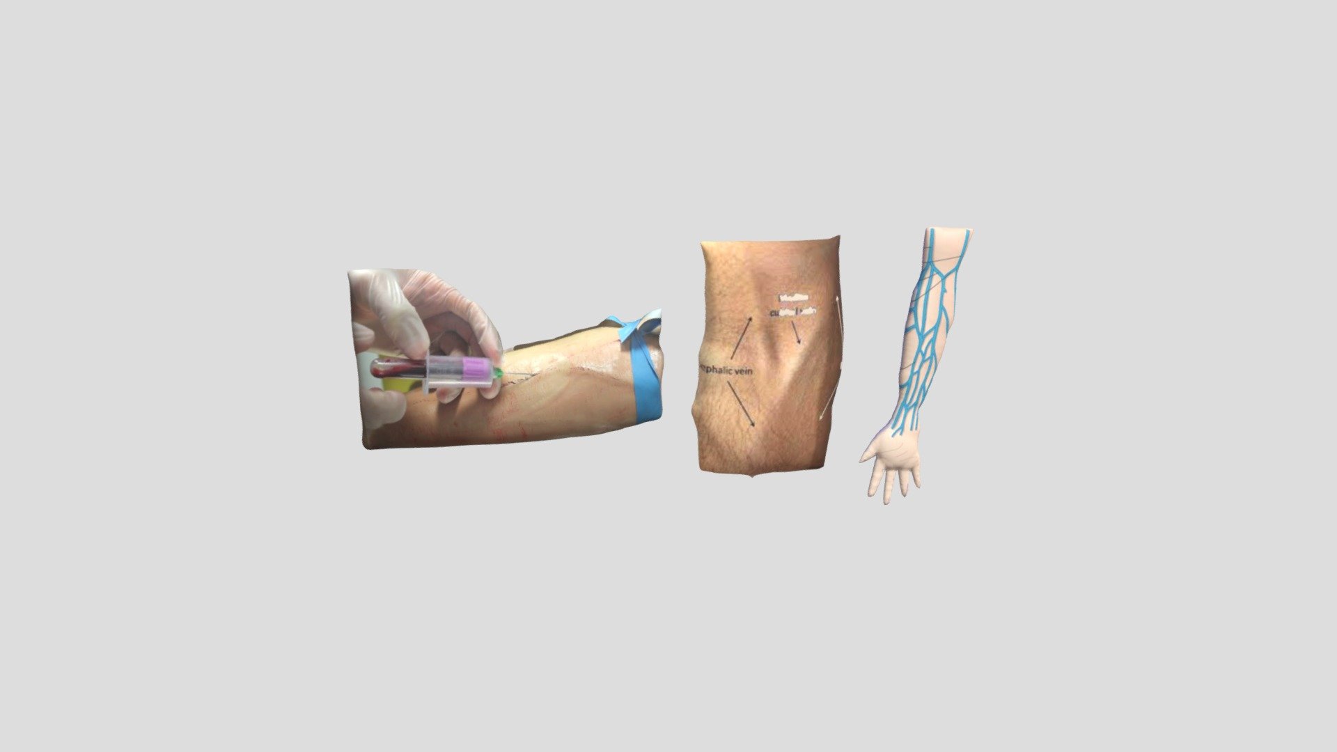 Praktek Flebotomi - Download Free 3D model by khoirulanam [e6723f4 ...