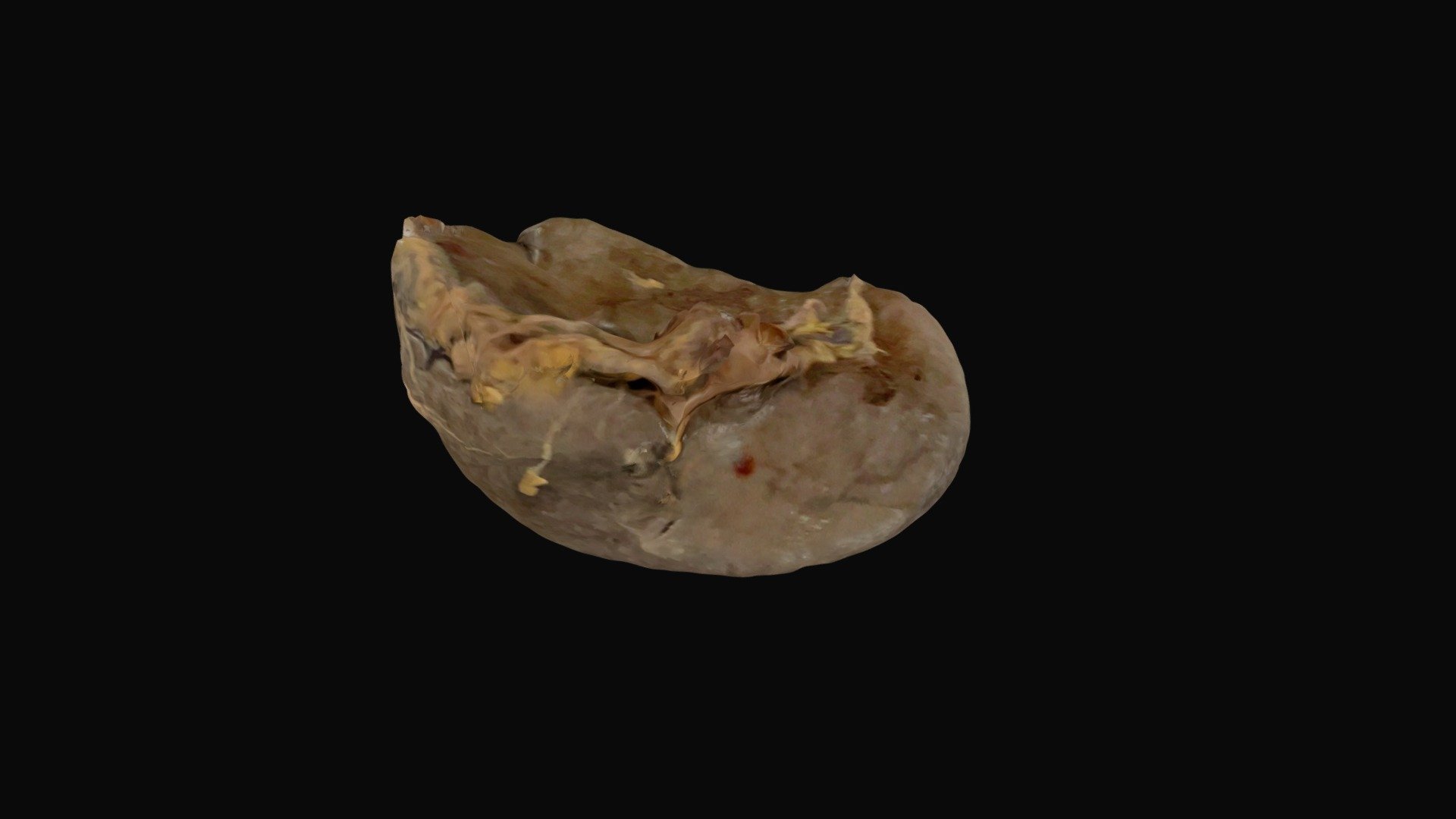Spleen - 3D model by prajjawalit [e683a41] - Sketchfab
