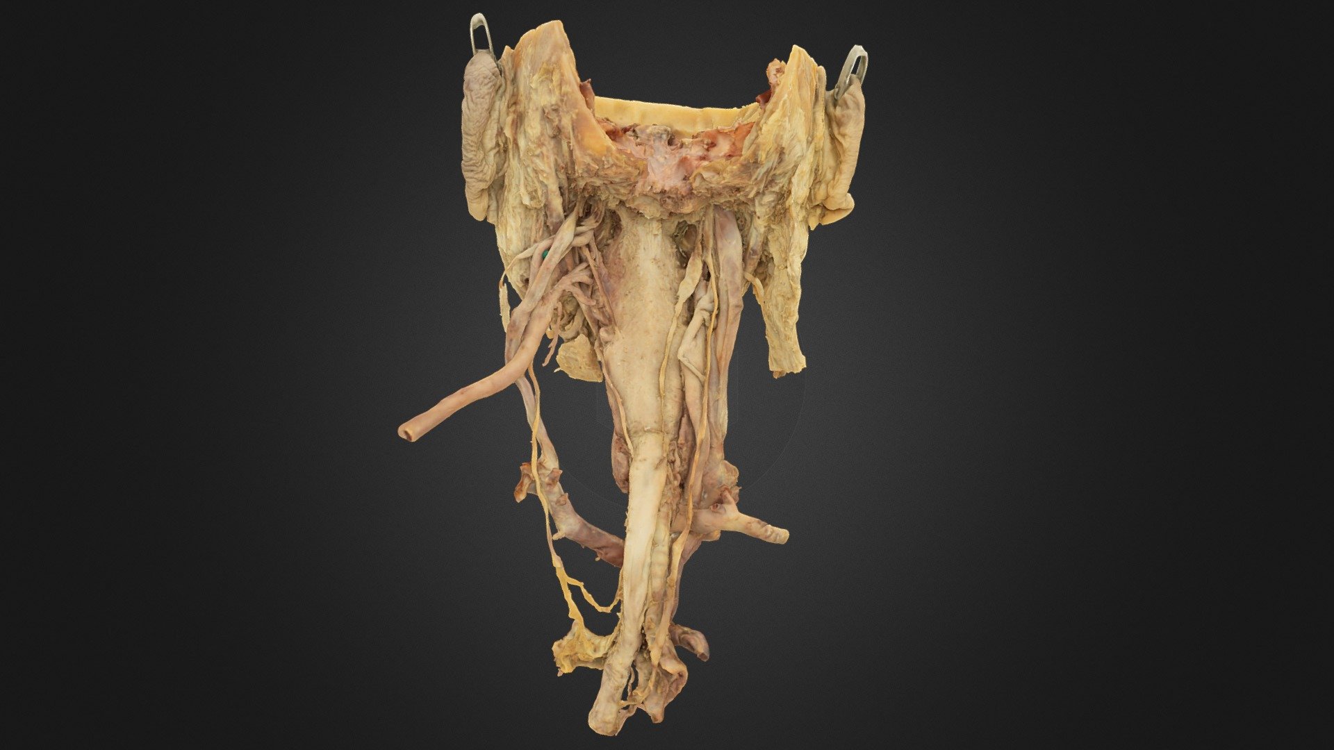 Deep Neck and Pharynx - 3D model by UBC Medicine - Educational Media ...