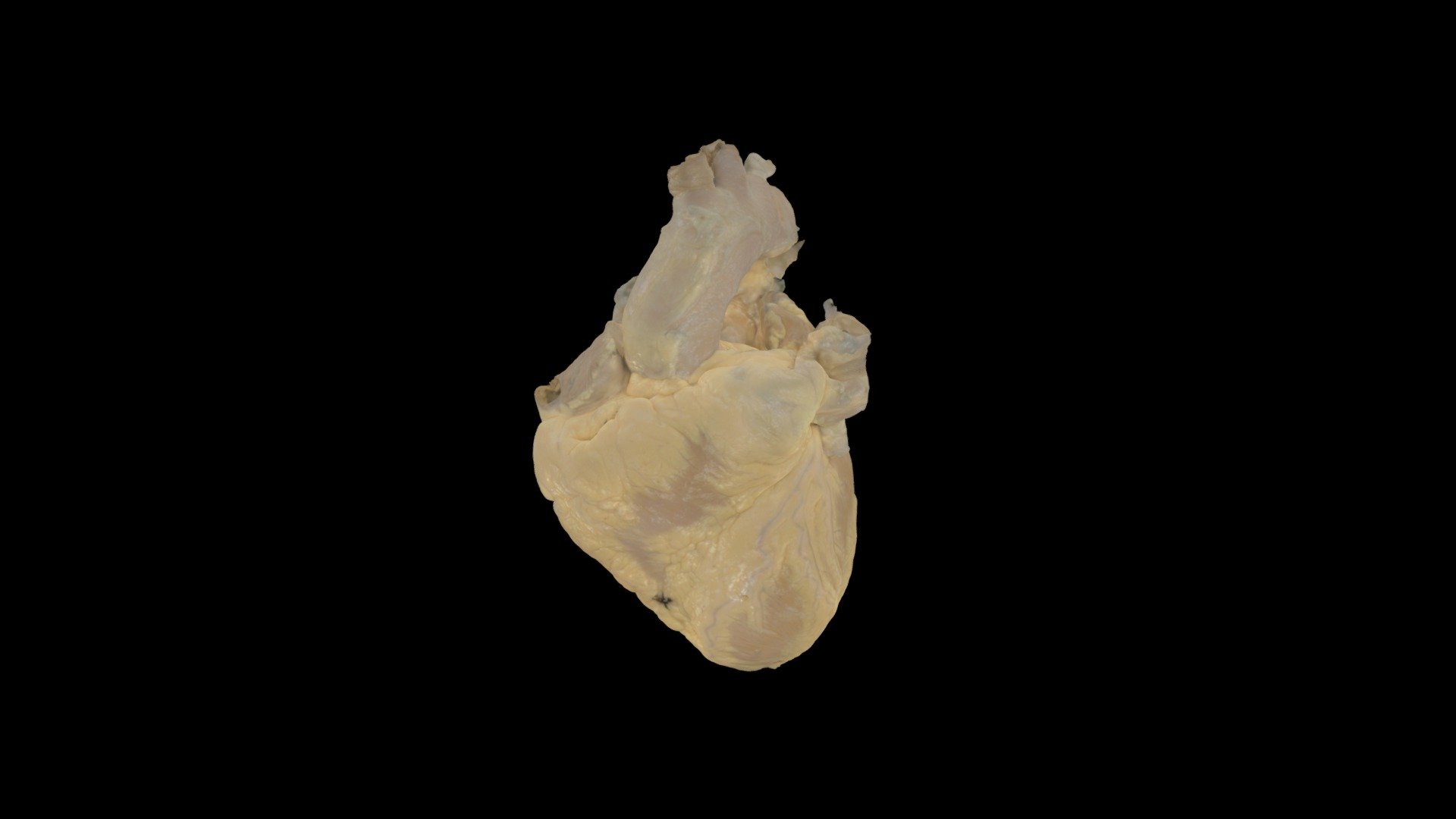 Fixed Human Heart with Preserved Aortic Arch - Download Free 3D model ...