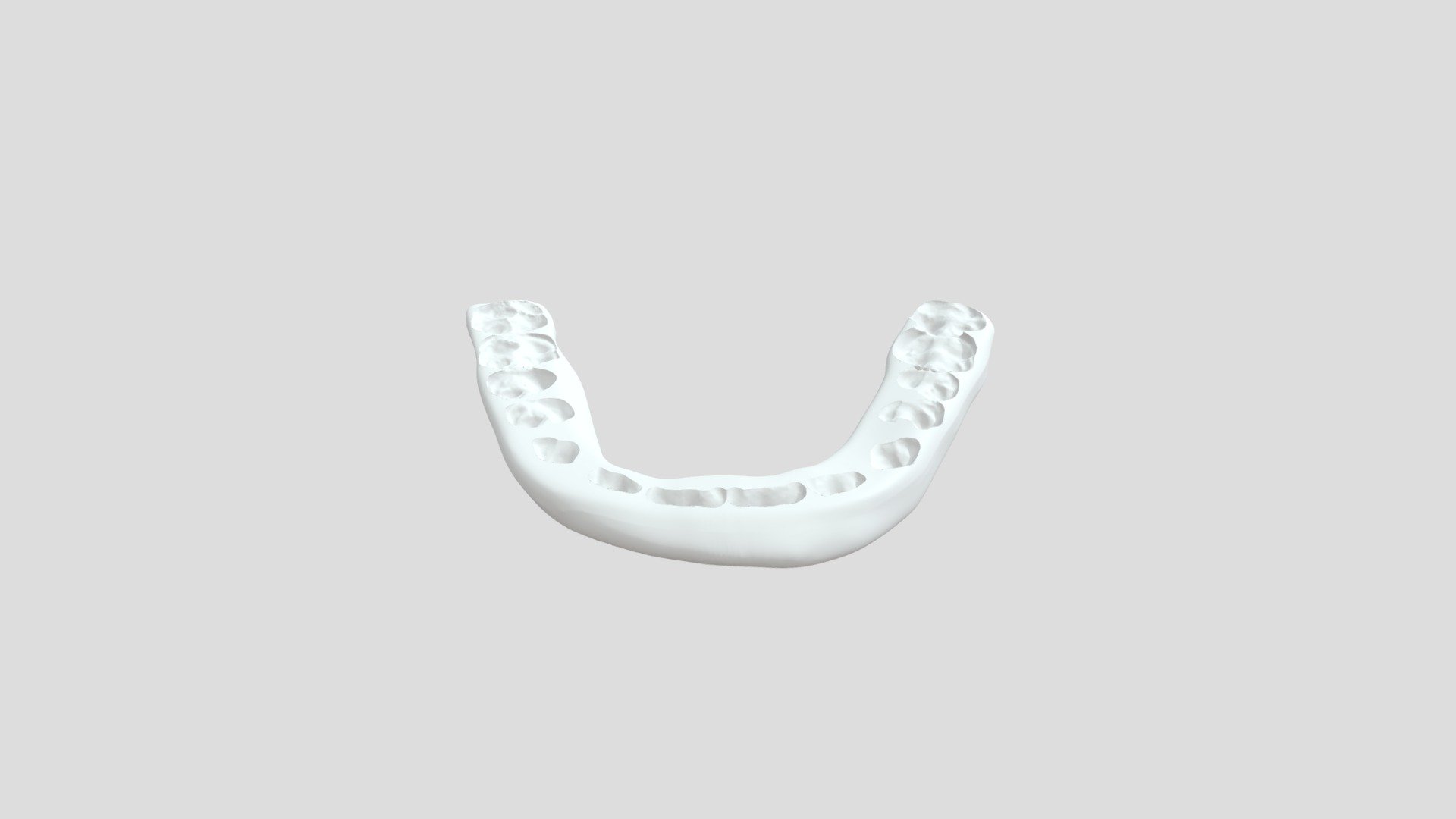 SPLINT_INTER MENESES JORDAN - 3D model by Dr. Rodrigo Salazar Gamarra ...